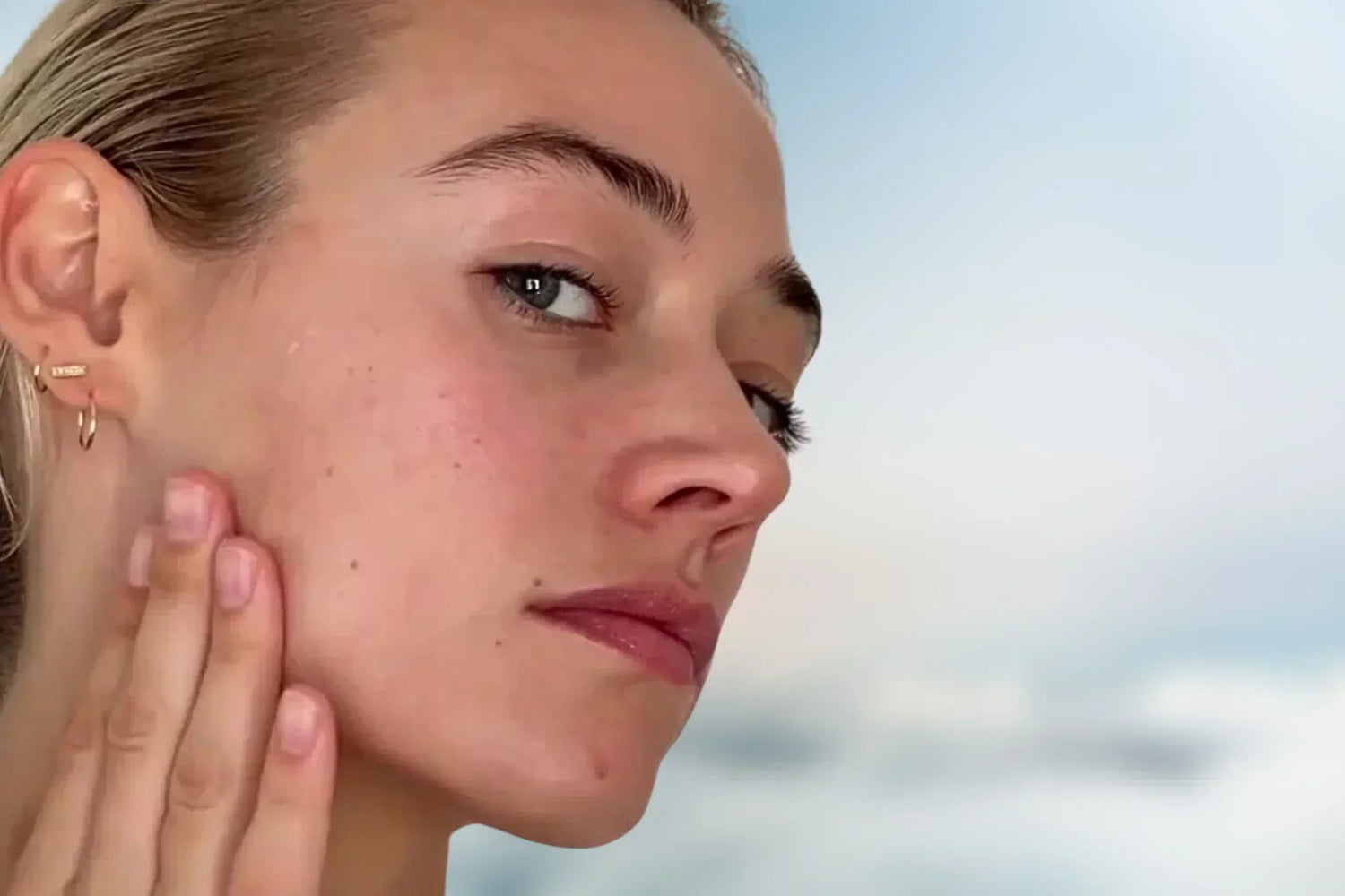 Summer Acne Breakouts: How to Prevent & Treat Warm-Weather Acne | Biba ...