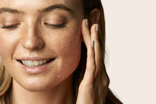 Hyperpigmentation Explained: Causes, Dark Spots & Skin Biology | Biba ...